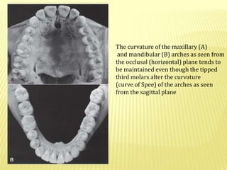 Maxillary Arch Occlusal View Anatomy
