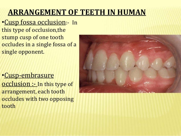 Occlusion