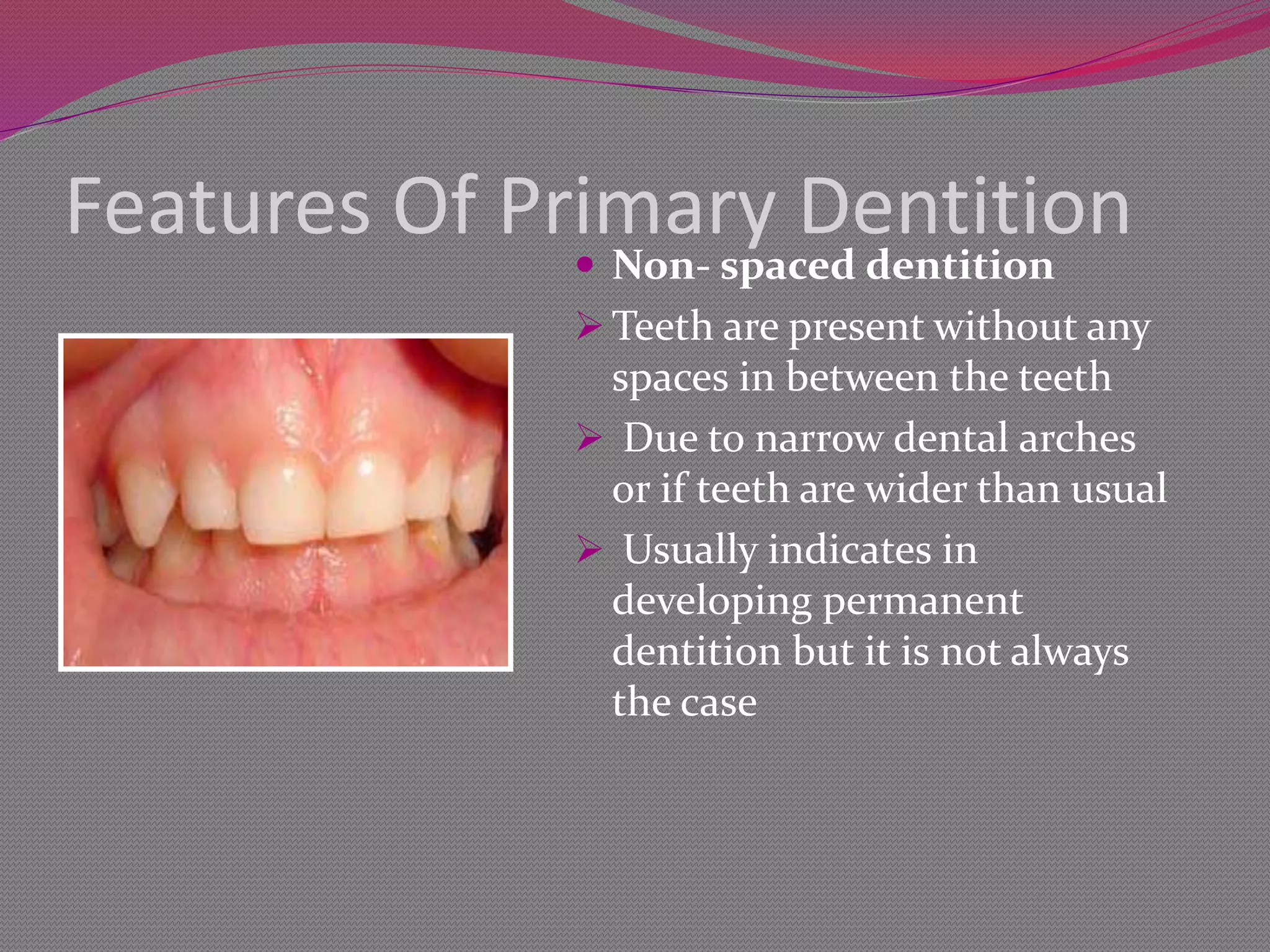 Occlusion | PPTX