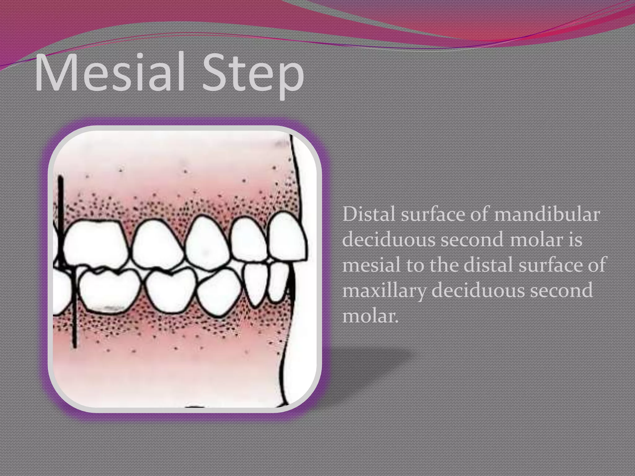 Occlusion | PPTX