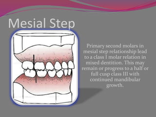 Occlusion | PPTX