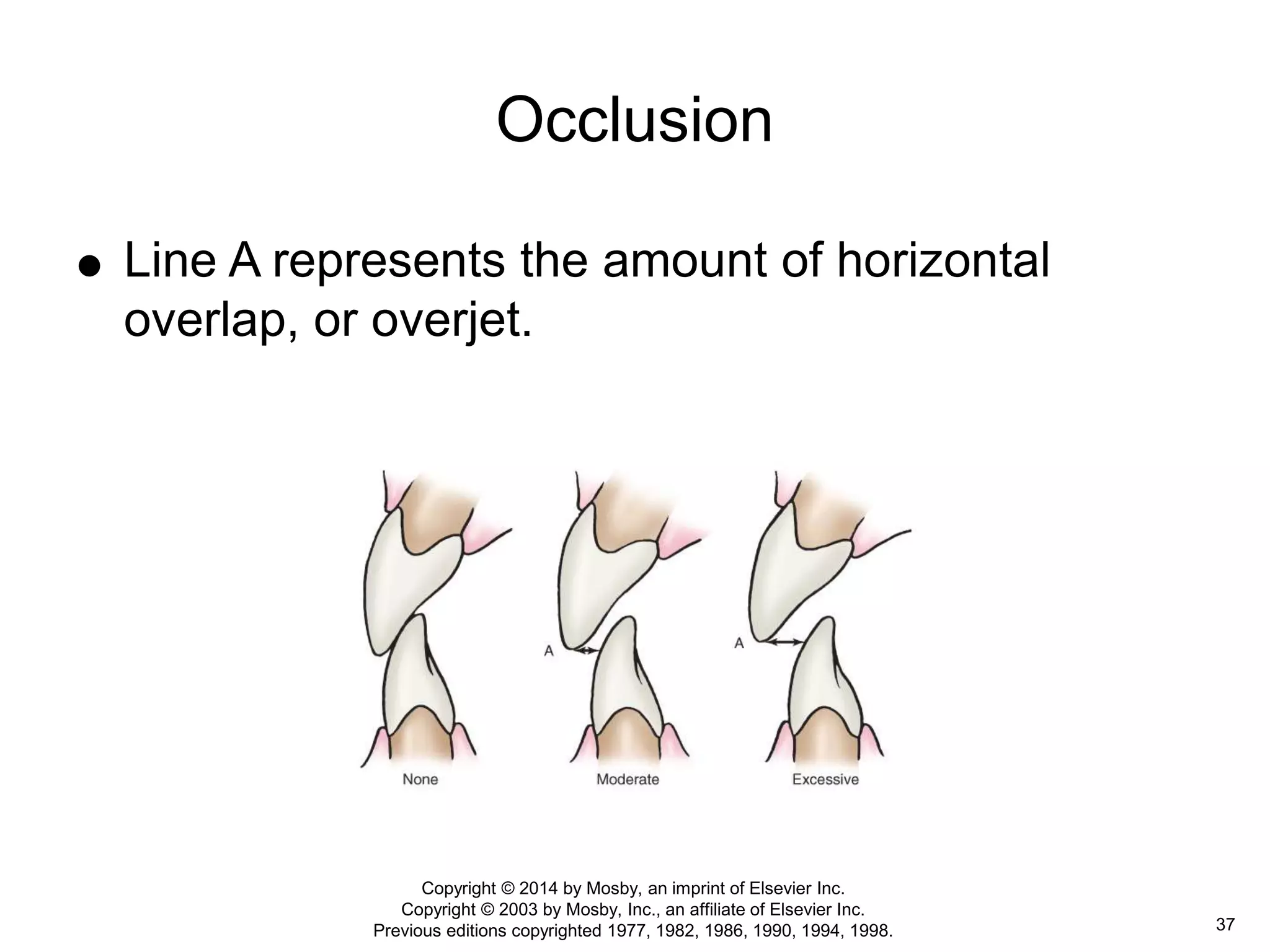 Basic Occlusion | PPT