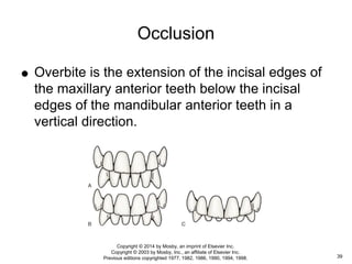 Basic Occlusion | PPTX
