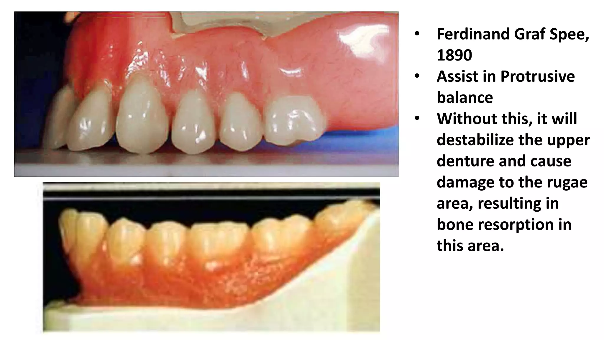 Occlusion in Complete denture | PPTX
