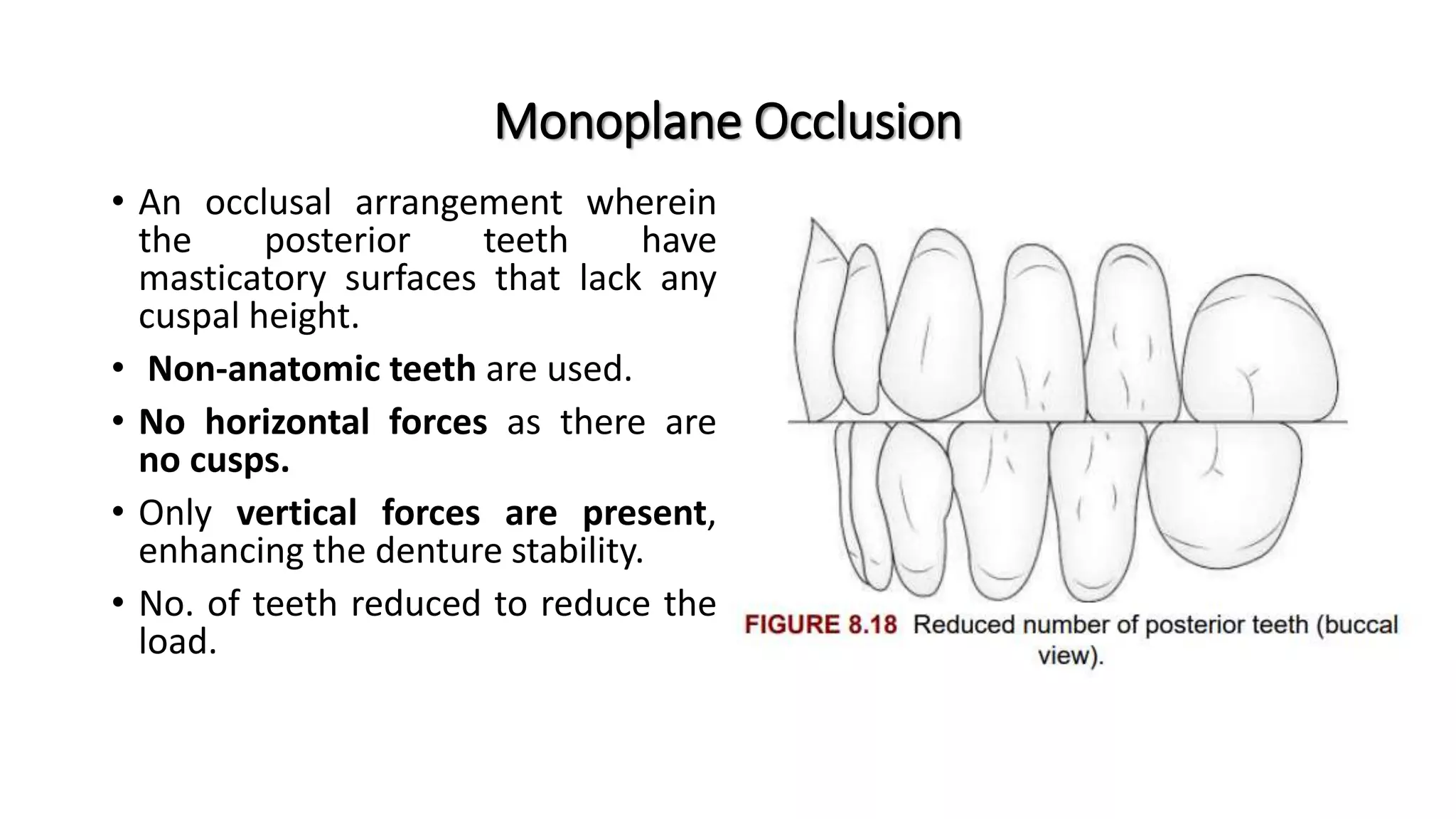Occlusion in Complete denture | PPTX