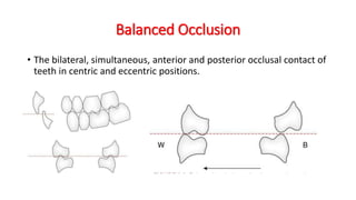 Occlusion in Complete denture | PPTX