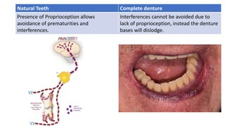 Occlusion in Complete denture | PPTX