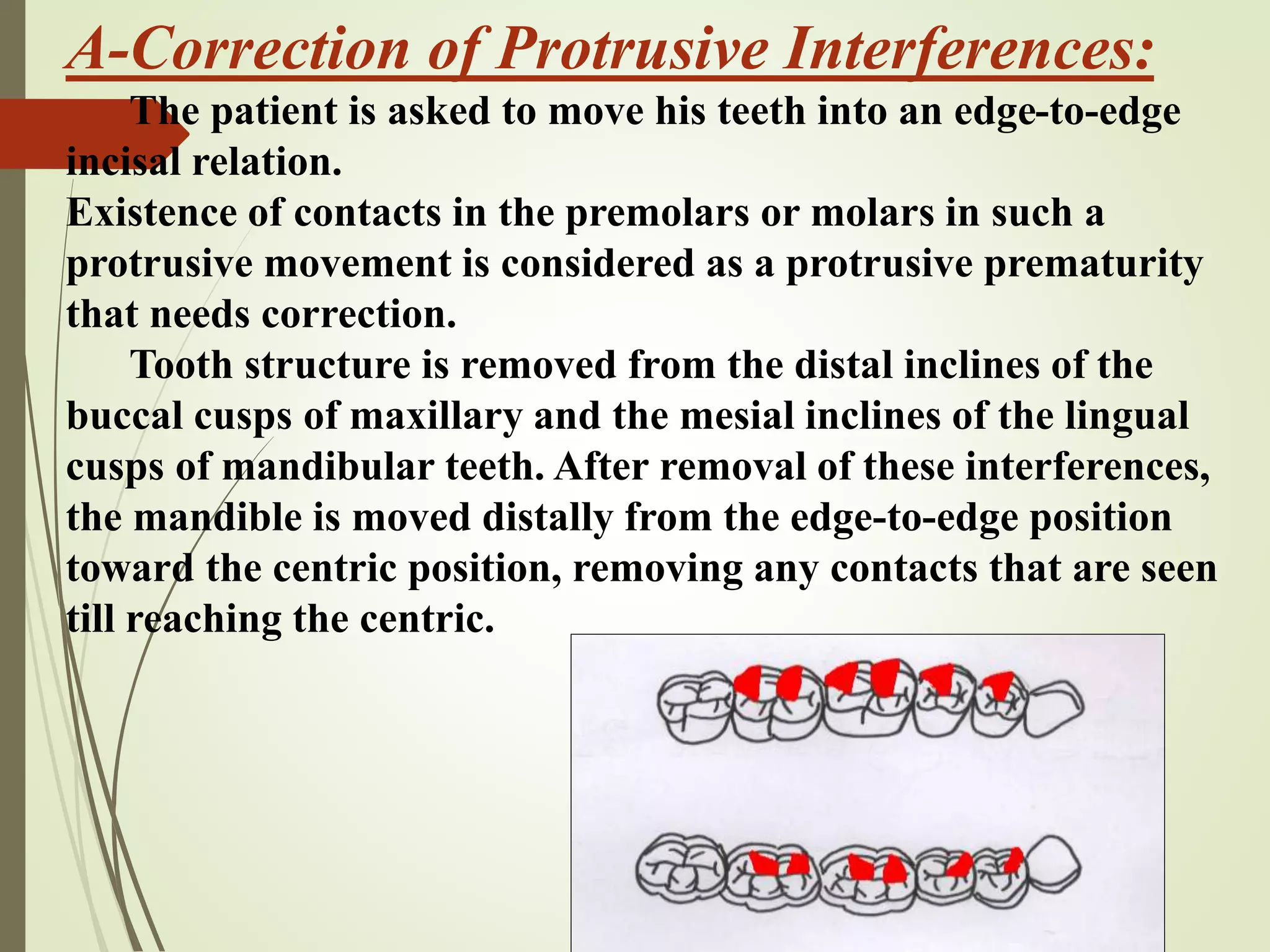occlusion.pptx