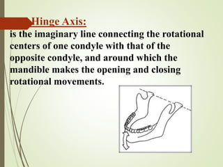 occlusion.pptx