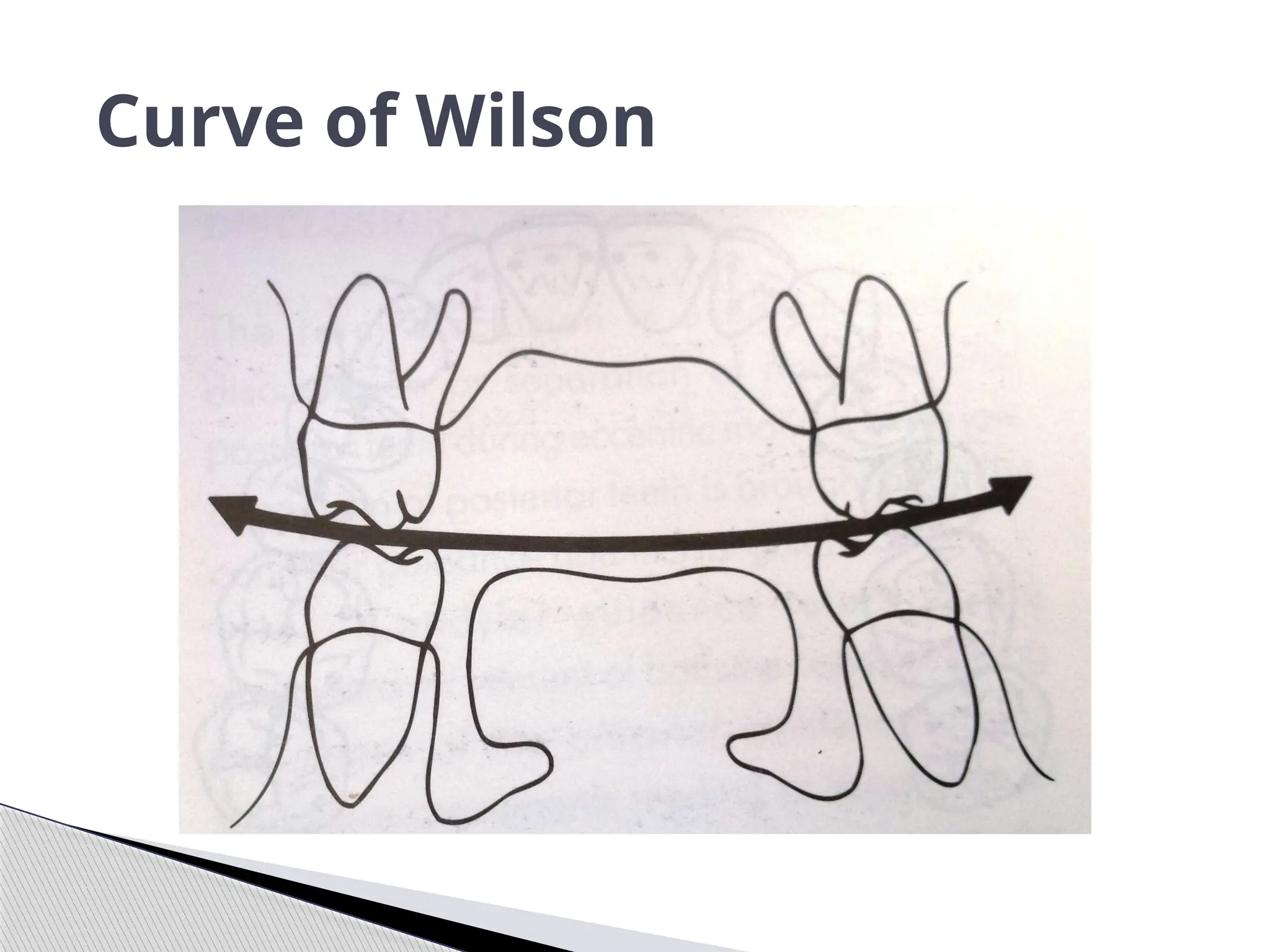 OCCLUSION- Occlusion is a complex phenomenon involving the teeth ...