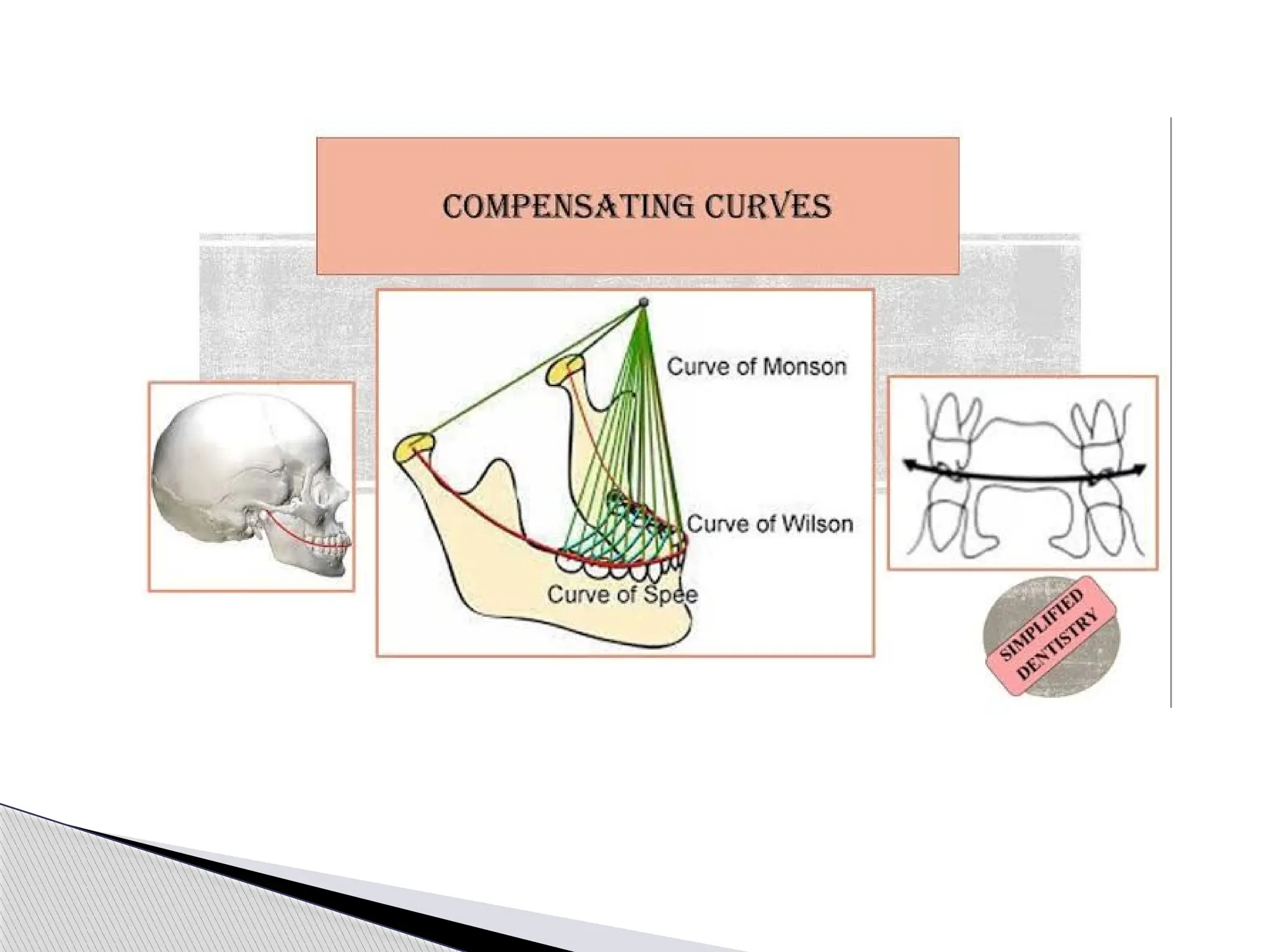 OCCLUSION- Occlusion is a complex phenomenon involving the teeth ...