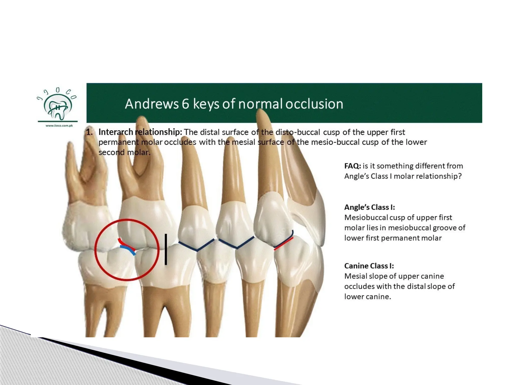 OCCLUSION- Occlusion is a complex phenomenon involving the teeth ...