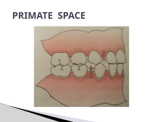 OCCLUSION- Occlusion is a complex phenomenon involving the teeth ...