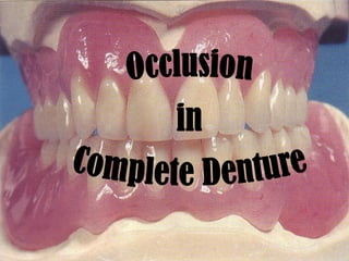 Occlusion in complete denture basic concept | PDF