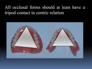 Occlusion in complete denture basic concept | PDF