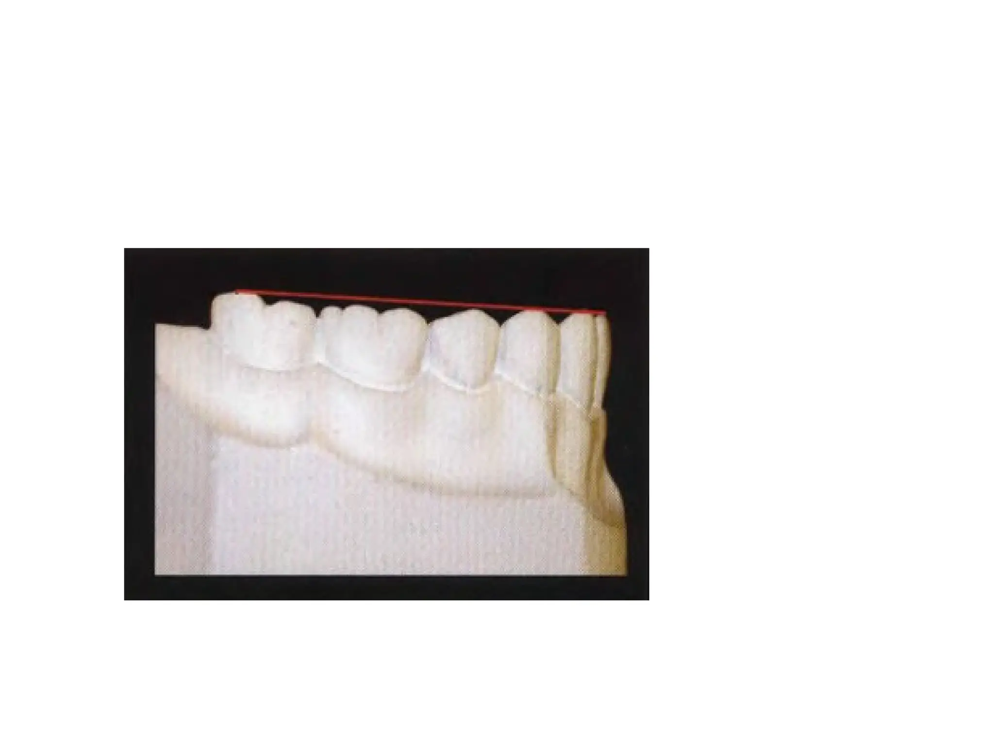 orthodontics definition,classificationOcclusion.pptx