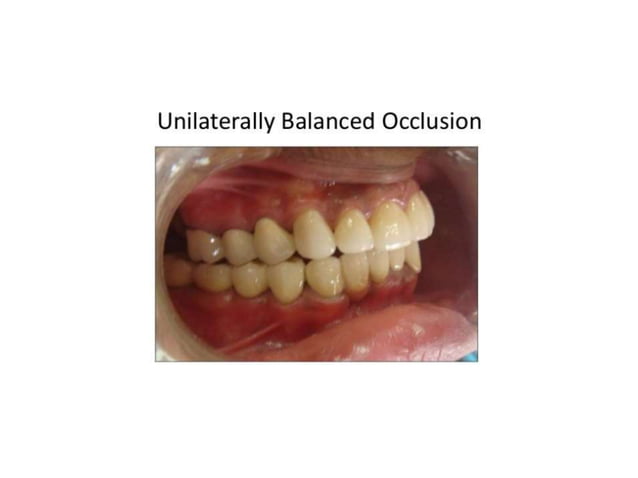 occlusion mmmmmmmm- Copy [Autosaved].pptx