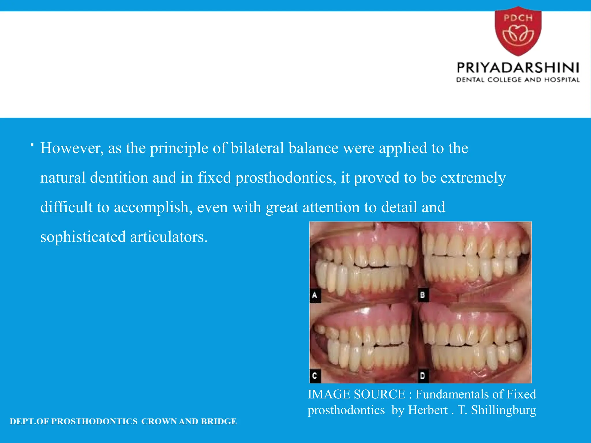 Occlusion of fixed bridges and crowns dentistry | PPTX