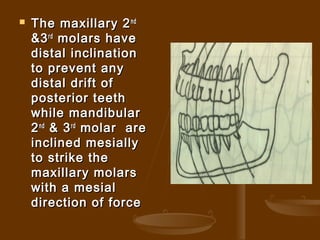 Dental Occlusion | PPT
