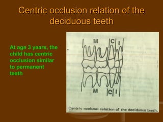 Dental Occlusion | PPT