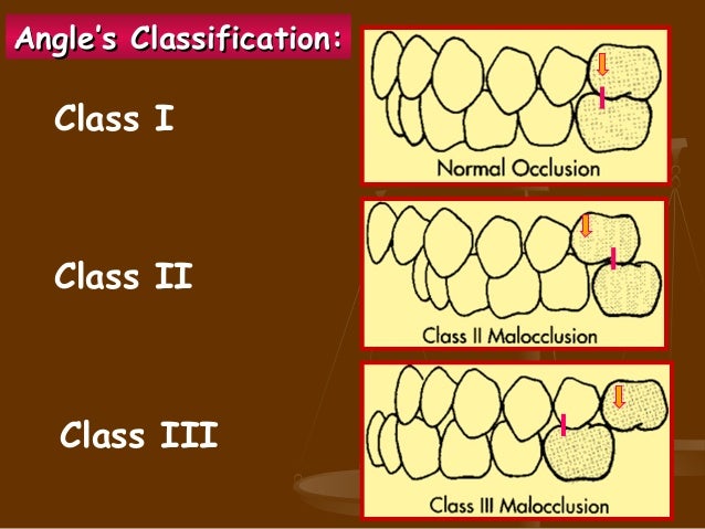 Dental Occlusion