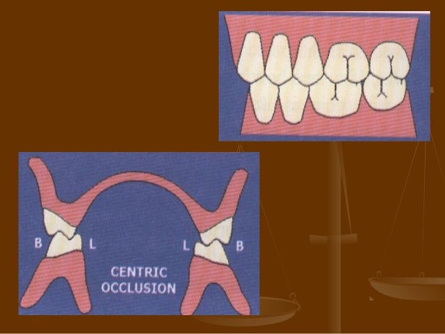 Dental Occlusion