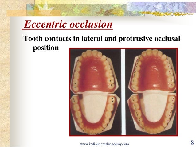 Occlusion