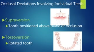Occlusion and form and function | PPTX
