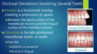 Occlusion and form and function | PPTX