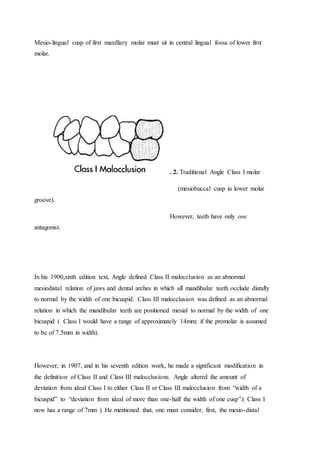 Occlusion and orthodontics by Almuzian | DOCX
