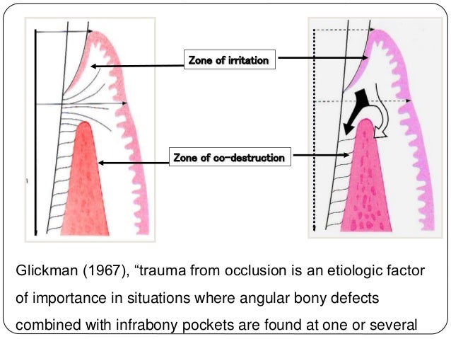 Occlusion basic
