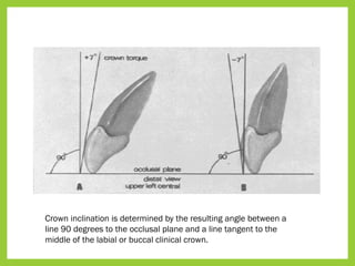 Occlusion – Basic concepts presentation | PPT
