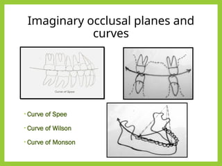 Occlusion – Basic concepts presentation | PPT