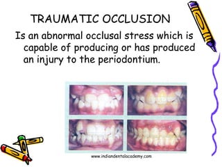 Occlusion basics | PPT