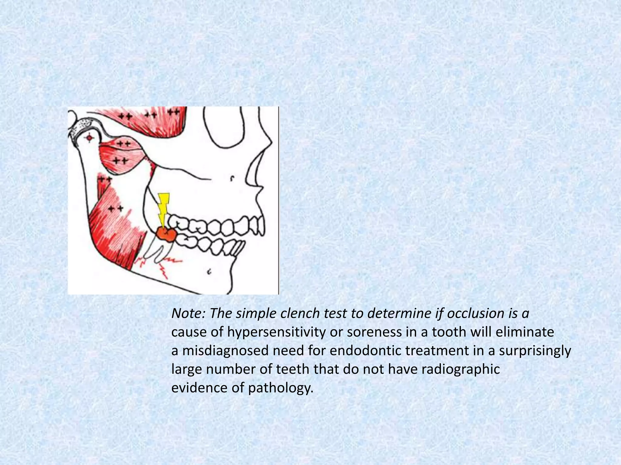 Occlusion diseases | PPTX