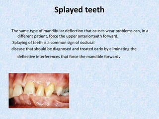 Occlusion diseases | PPT