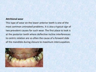 Occlusion diseases | PPTX