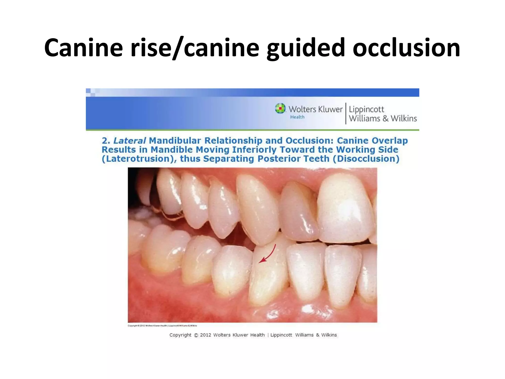 Occlusion dr jameel demonstration | PPTX