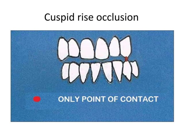 Occlusion dr jameel demonstration | PPT