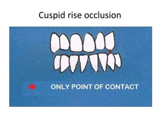 Occlusion dr jameel demonstration | PPT