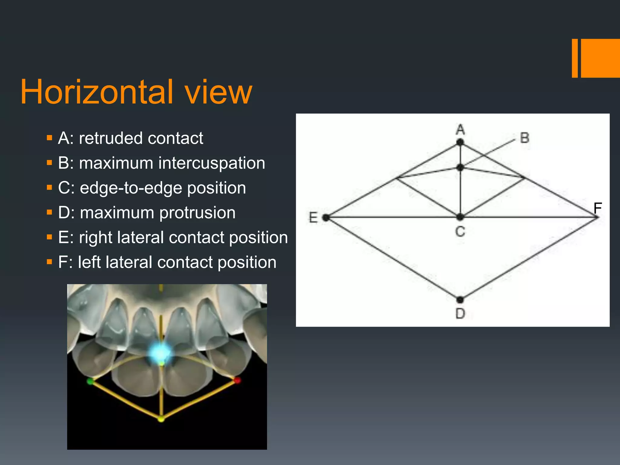 Occlusion for prosthodontics | PPTX