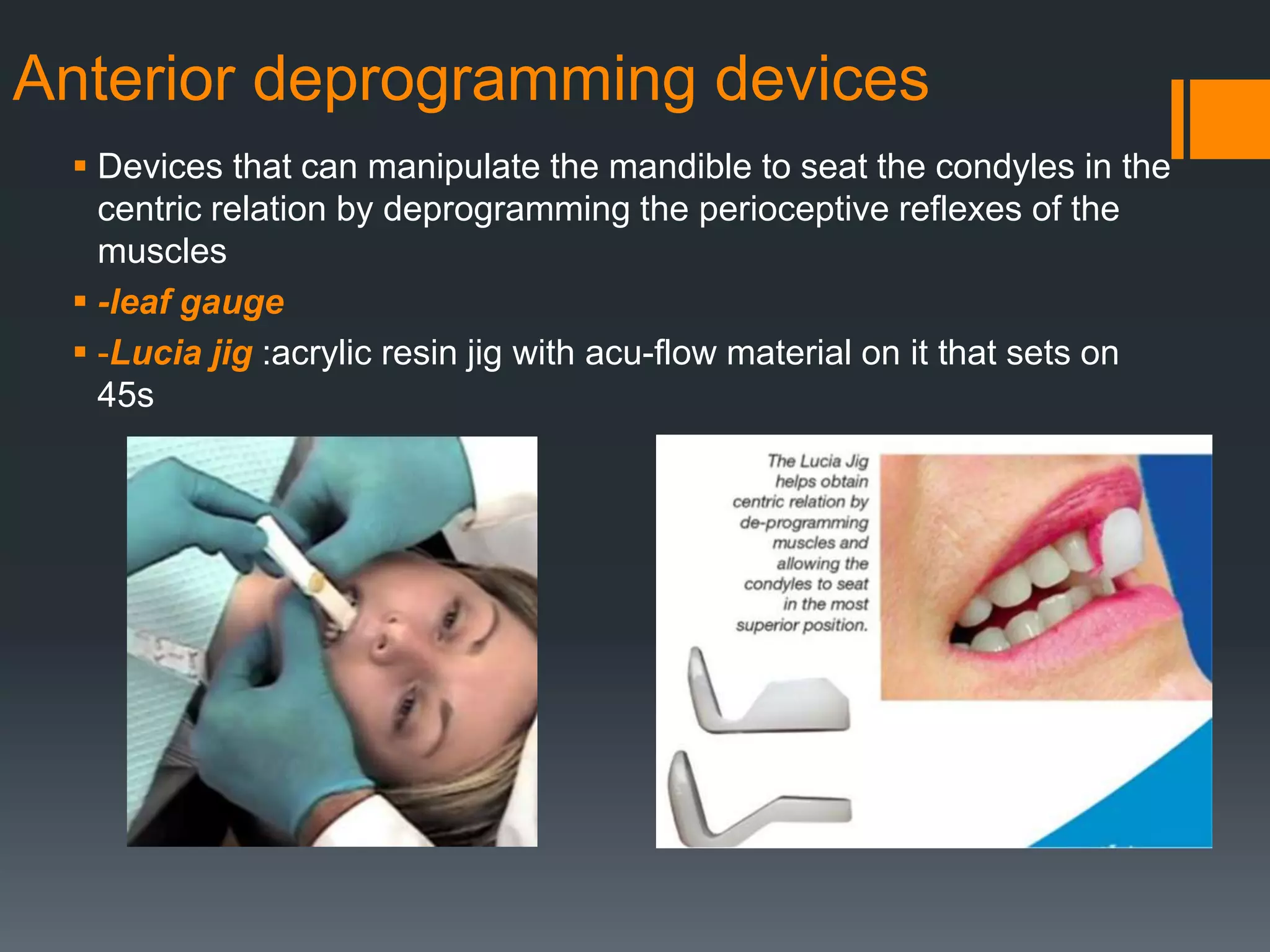 Occlusion for prosthodontics | PPTX