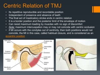 Occlusion for prosthodontics | PPTX