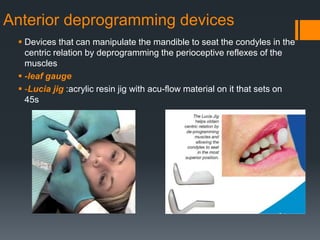 Occlusion for prosthodontics | PPTX