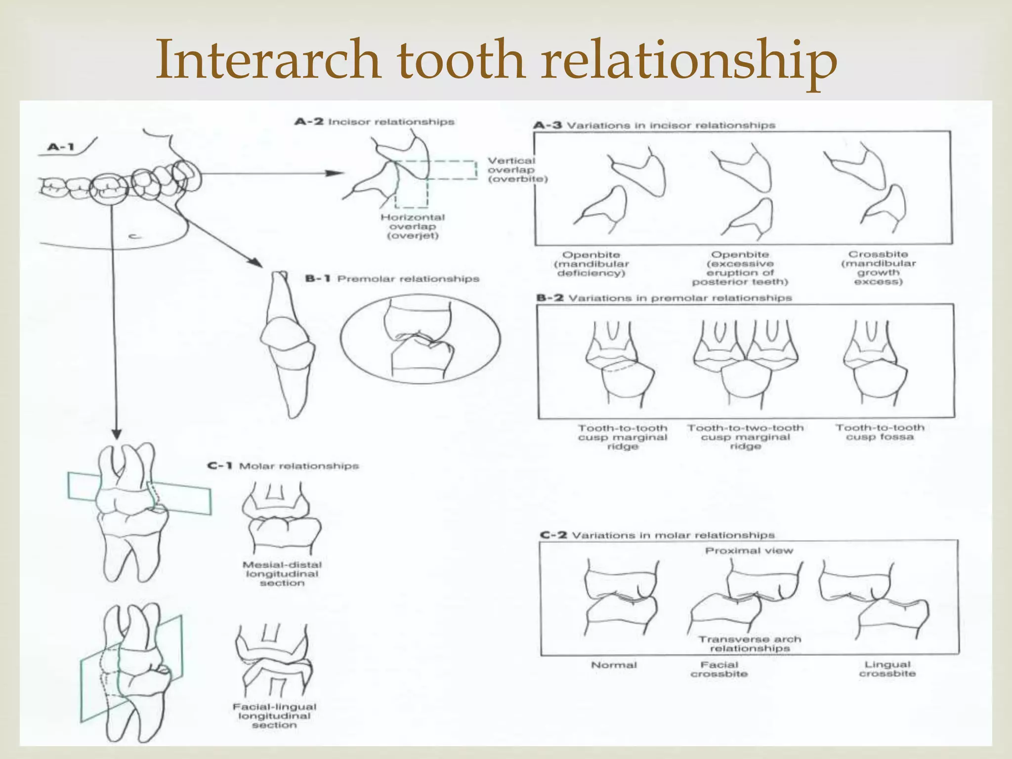 Occlusion in conservative dentistry | PPTX