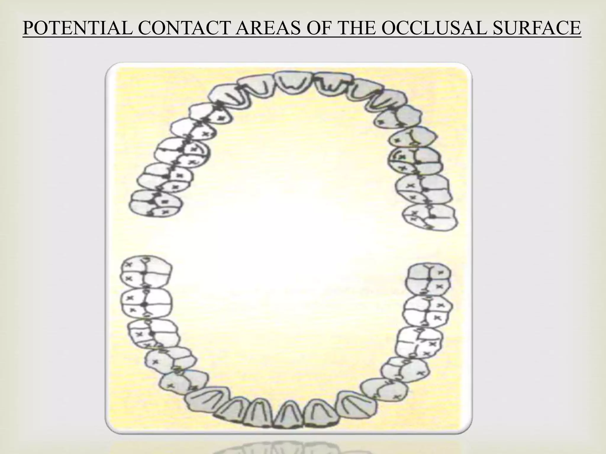 Occlusion in conservative dentistry | PPTX