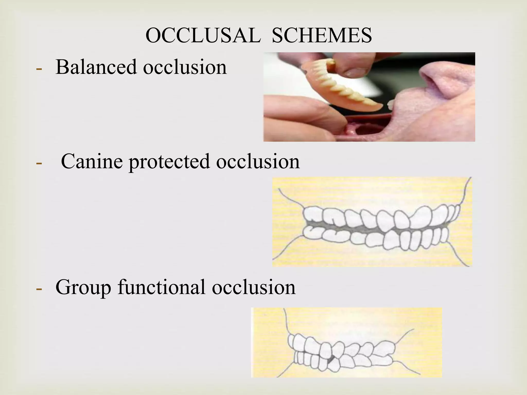Occlusion in conservative dentistry | PPTX