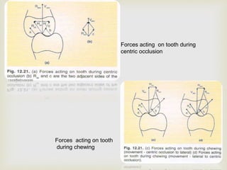 Occlusion in conservative dentistry | PPTX
