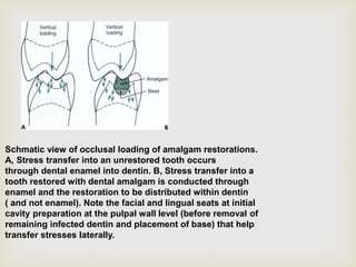 Occlusion in conservative dentistry | PPTX