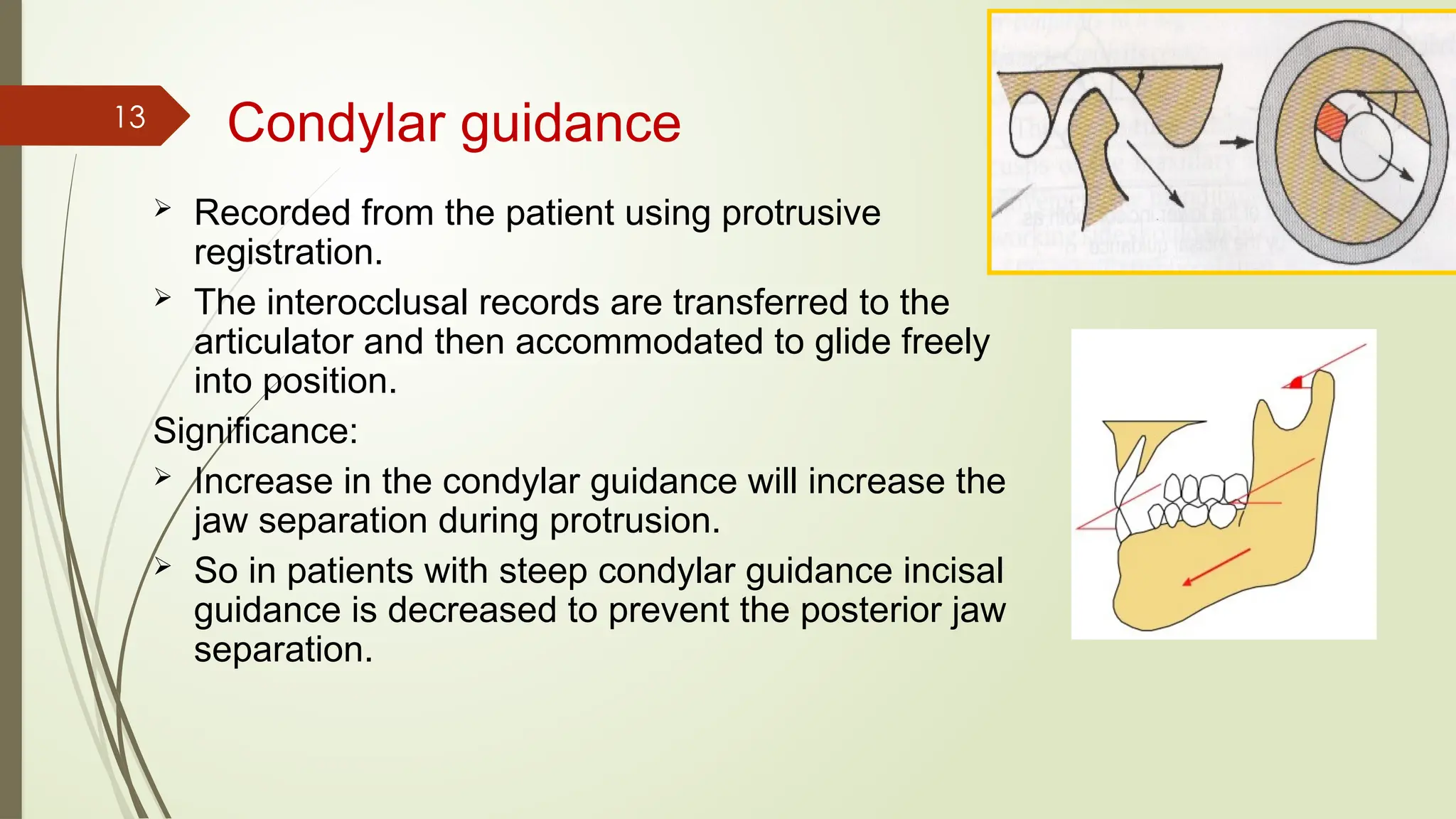 Occlusion in CD.pptx